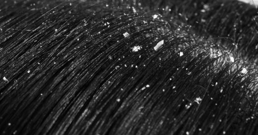 How To Tell If You Have Product Buildup In Your Hair (4 Signs)